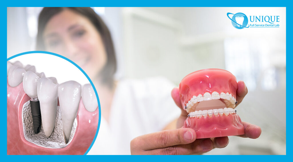How does a porcelain restoration complete your dental implant?
